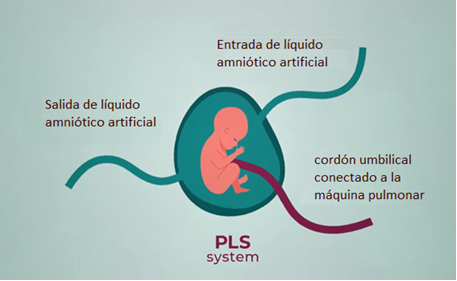 La ectogénesis: úteros artificiales para apoyar a bebés prematuros ...